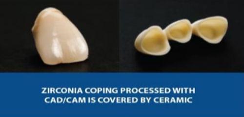 Zirconia - Shiken Manila Corporation