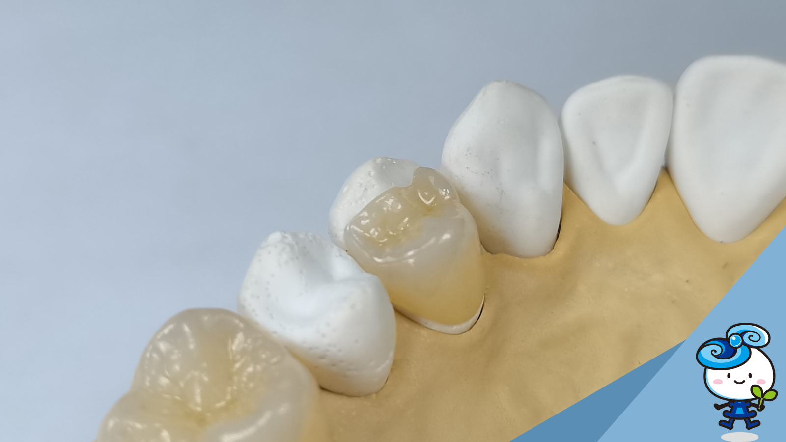 Full Zirconia-Onlay - Shiken Manila Corporation